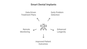 Smart Dental Implants with Sensors for Oral Health